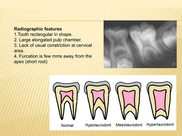 CONGENITAL AND DEVELOPMENTAL DEFECTS OF TEETH.pptx