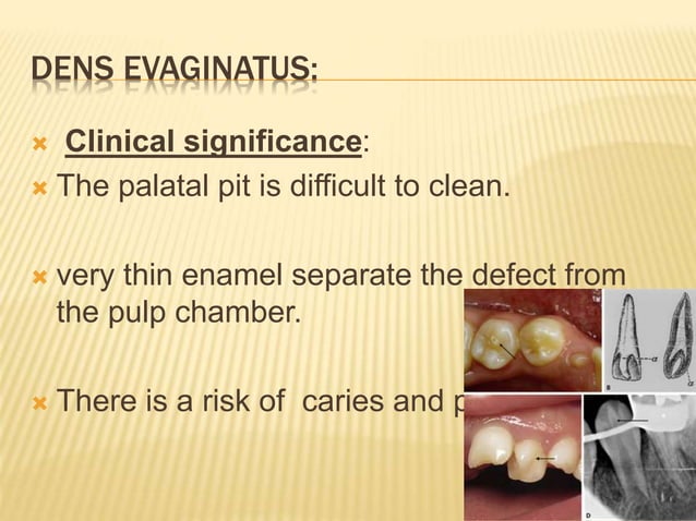 CONGENITAL AND DEVELOPMENTAL DEFECTS OF TEETH.pptx