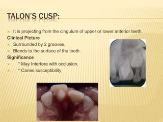 CONGENITAL AND DEVELOPMENTAL DEFECTS OF TEETH.pptx