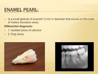 CONGENITAL AND DEVELOPMENTAL DEFECTS OF TEETH.pptx
