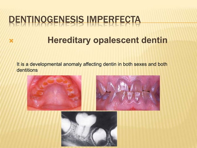 CONGENITAL AND DEVELOPMENTAL DEFECTS OF TEETH.pptx