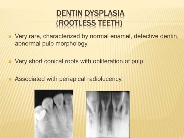 CONGENITAL AND DEVELOPMENTAL DEFECTS OF TEETH.pptx