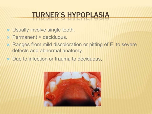 CONGENITAL AND DEVELOPMENTAL DEFECTS OF TEETH.pptx