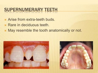 CONGENITAL AND DEVELOPMENTAL DEFECTS OF TEETH.pptx