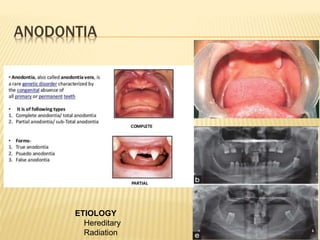 CONGENITAL AND DEVELOPMENTAL DEFECTS OF TEETH.pptx