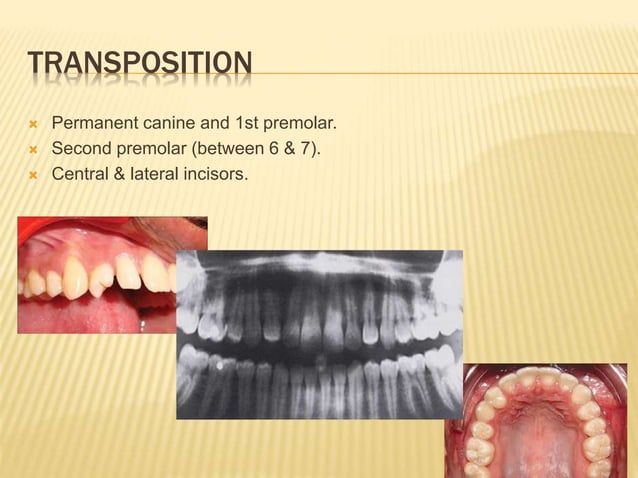 CONGENITAL AND DEVELOPMENTAL DEFECTS OF TEETH.pptx