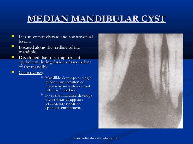 Congenital and developmental disorders of mandible