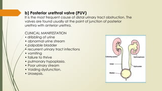 Congenital And Hereditary Renal Disorders.pptx