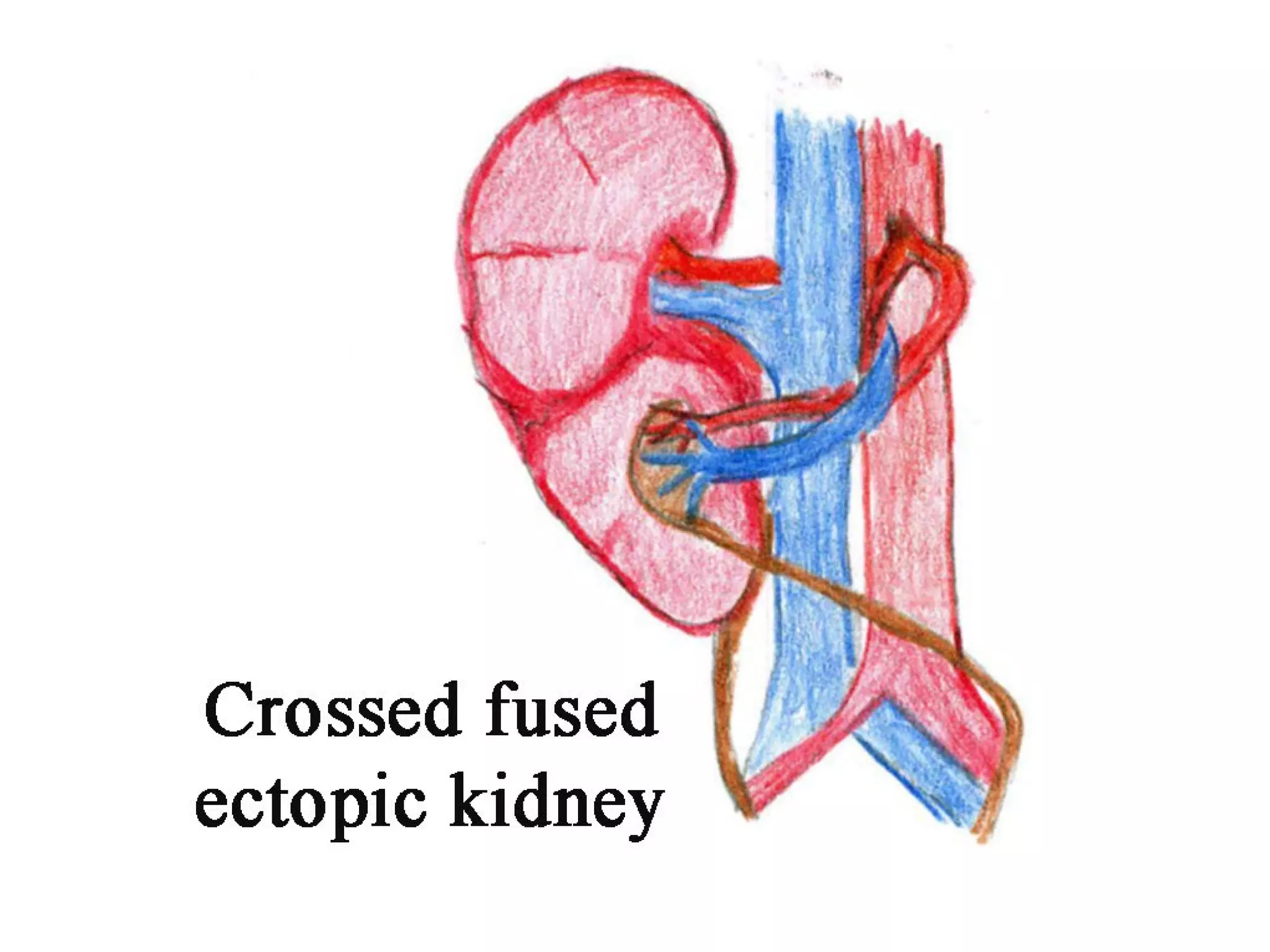 Diagnostic Imaging of Congenital Renal Anomalies | PPT