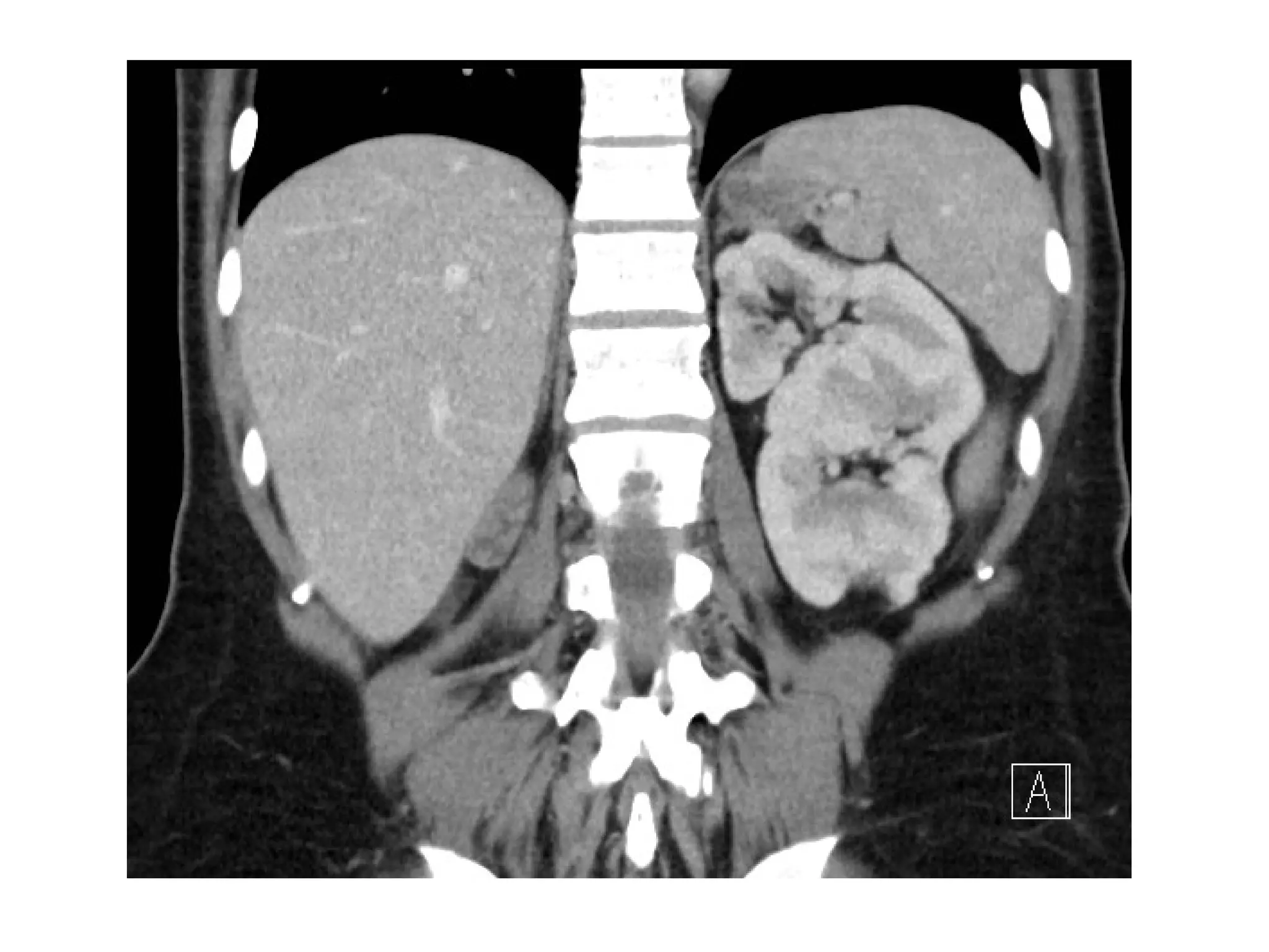 Diagnostic Imaging of Congenital Renal Anomalies | PPT