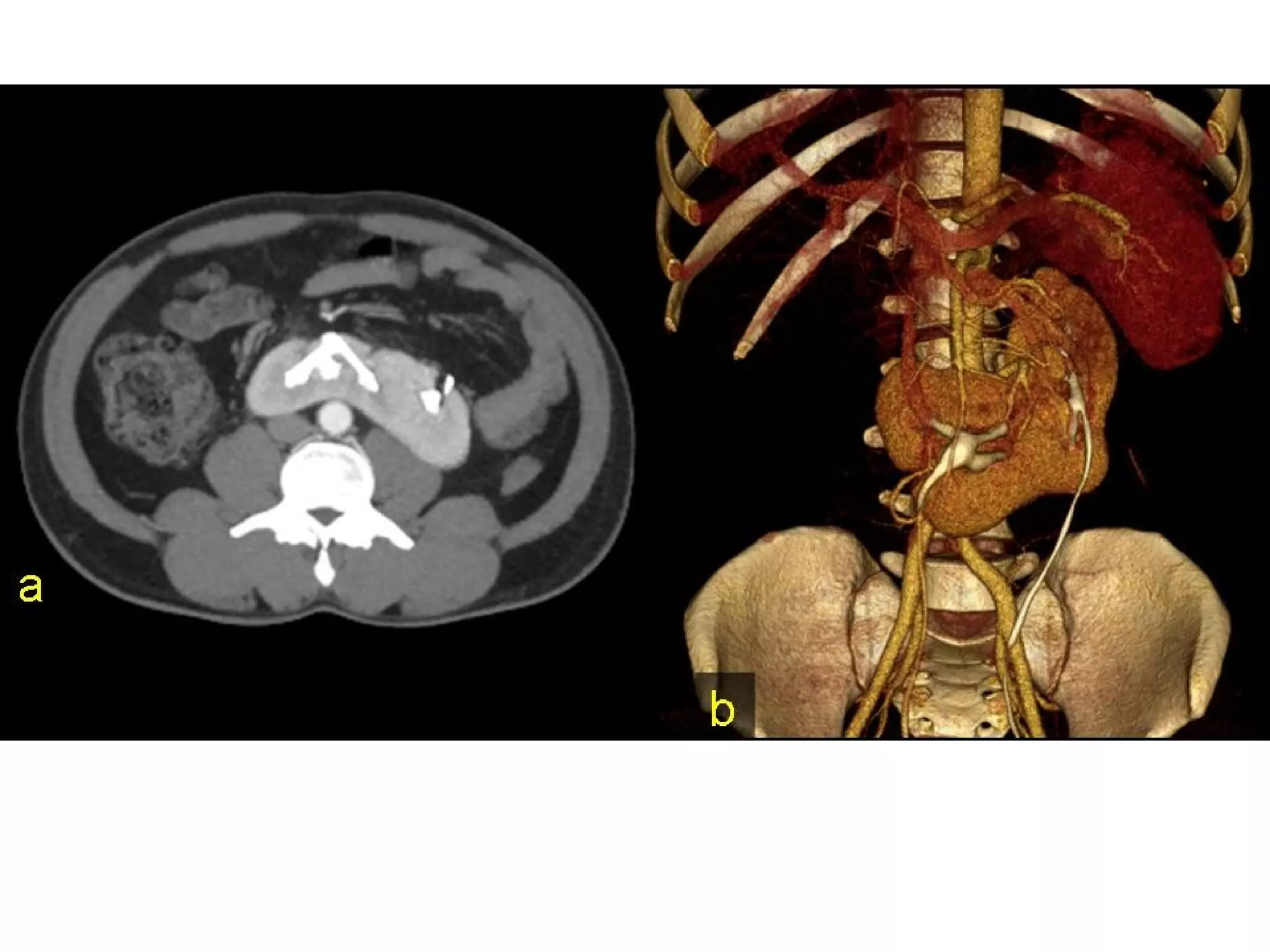 Diagnostic Imaging of Congenital Renal Anomalies | PPT