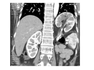 Diagnostic Imaging of Congenital Renal Anomalies | PPT