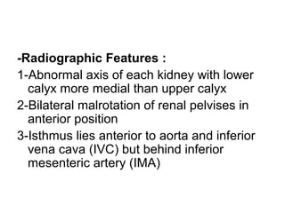 Diagnostic Imaging of Congenital Renal Anomalies | PPT