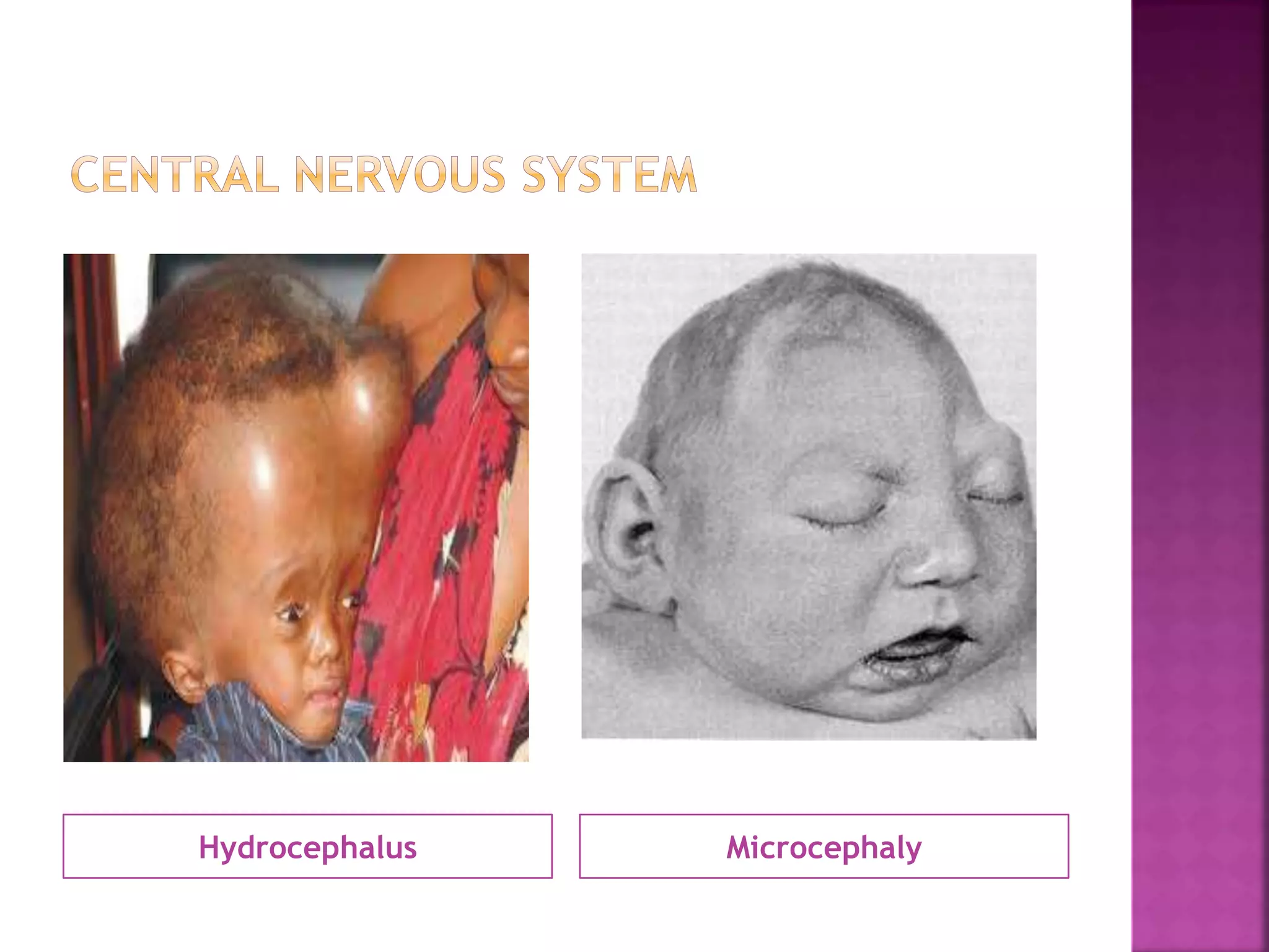 Congenital anomalies | PPTX