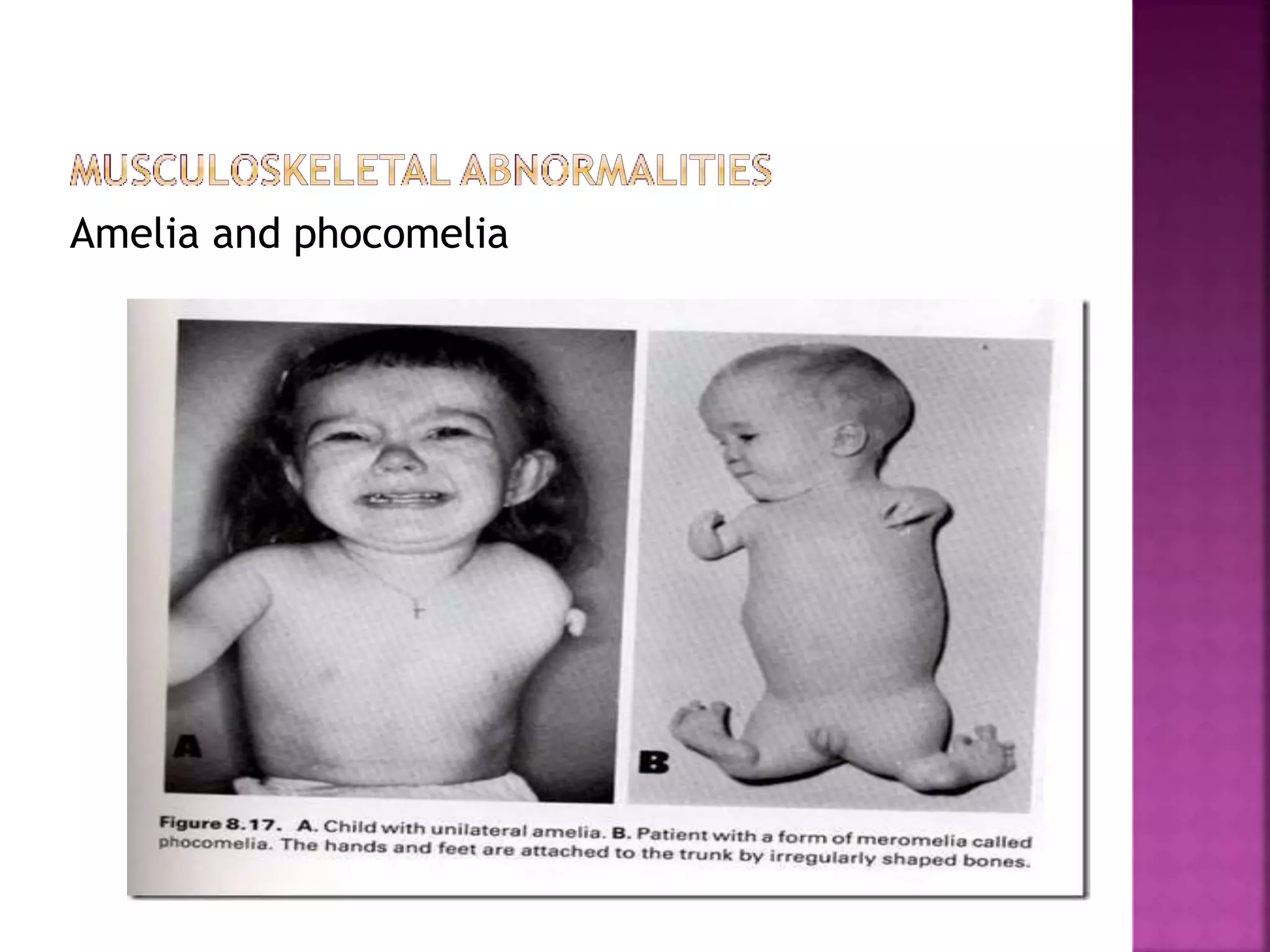 congenital anomalies.pptx