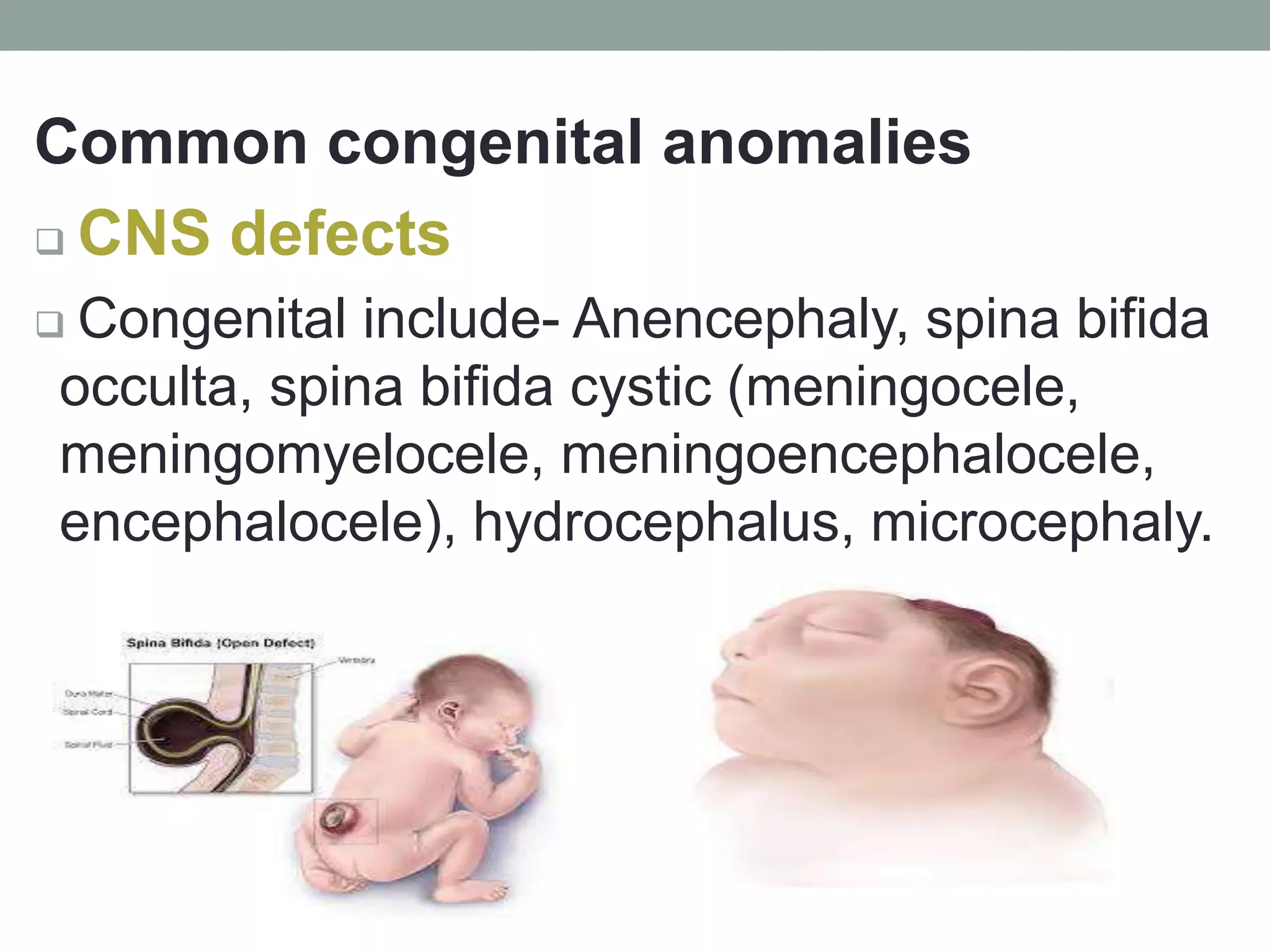 congenital anomalies.pptx