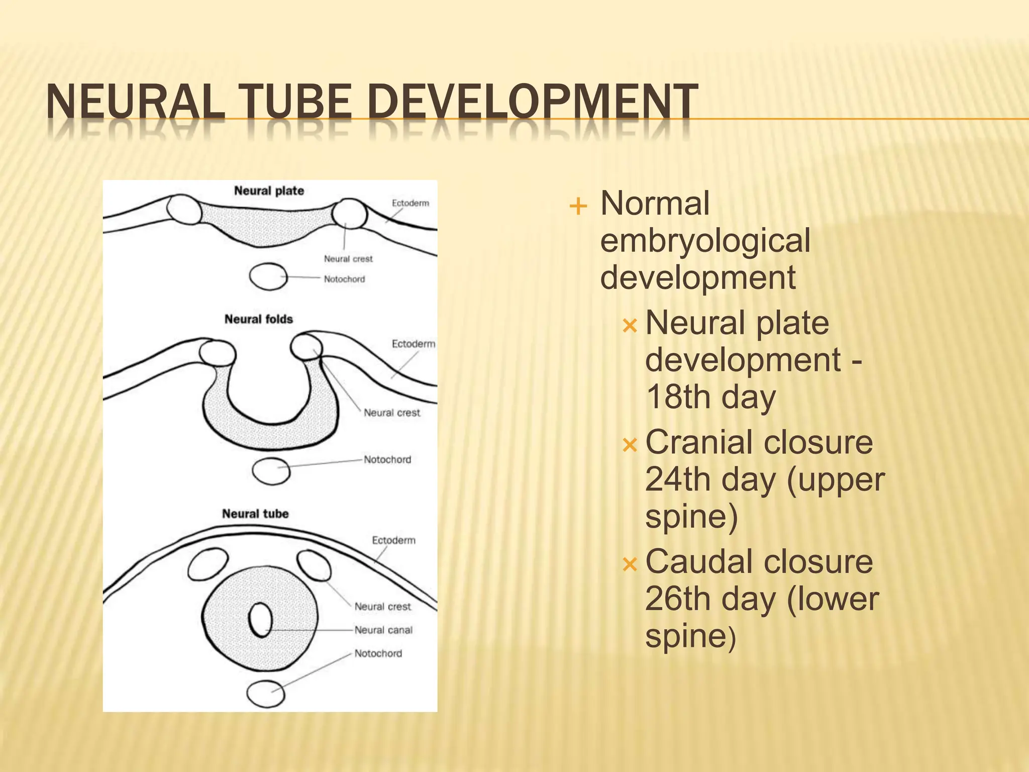 Congenital anomalies/Neural tube defects/ birth defects | PPTX