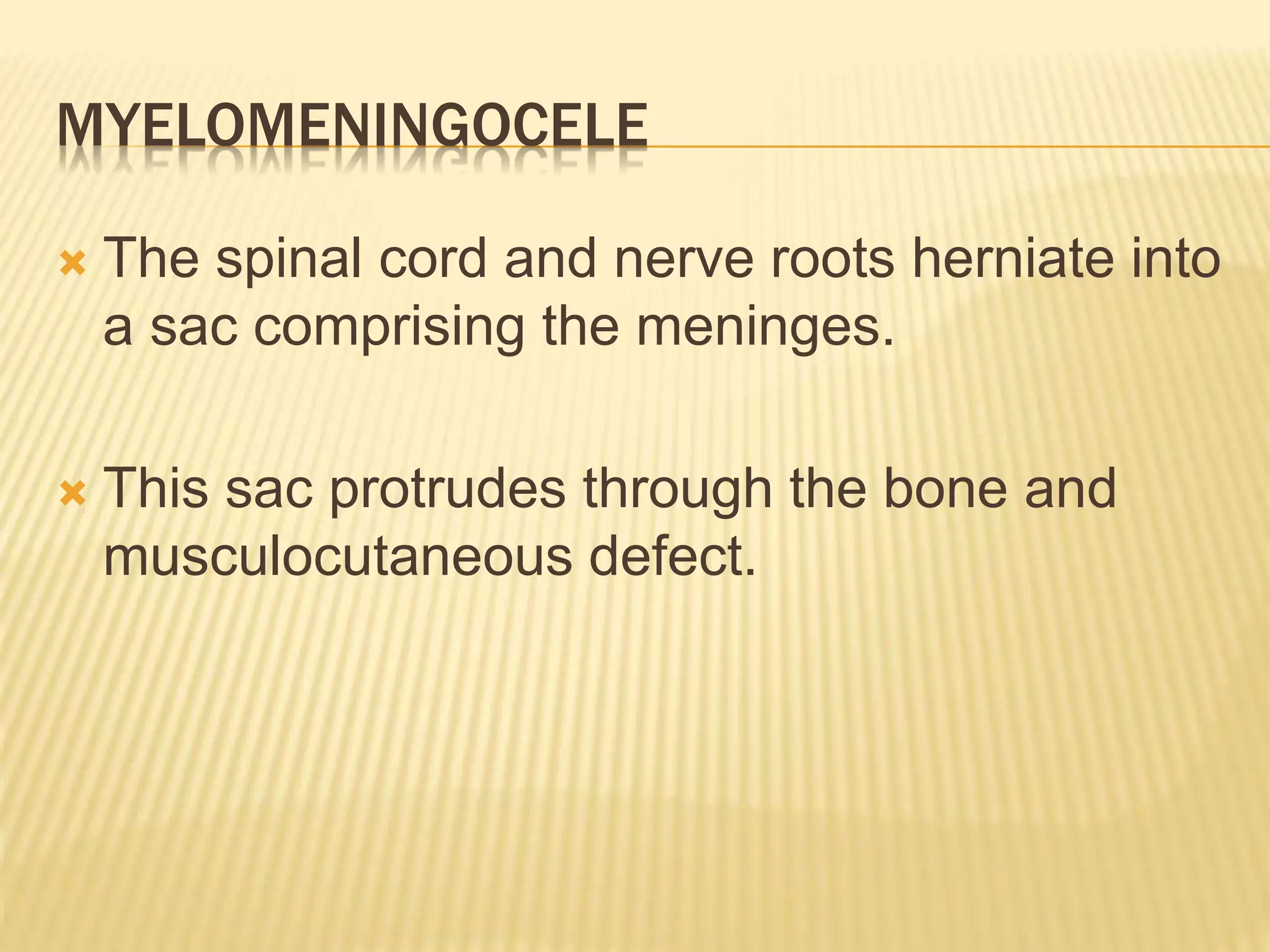 Congenital anomalies/Neural tube defects/ birth defects | PPTX