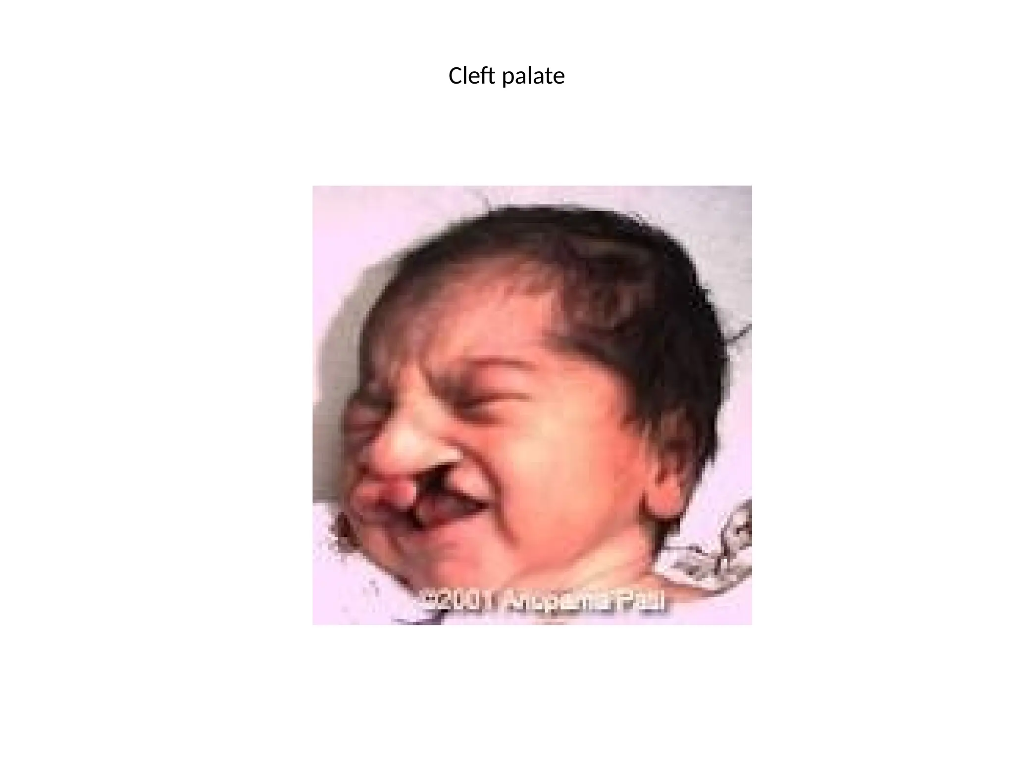 CONGENITAL ANOMALIES.identification.pptx