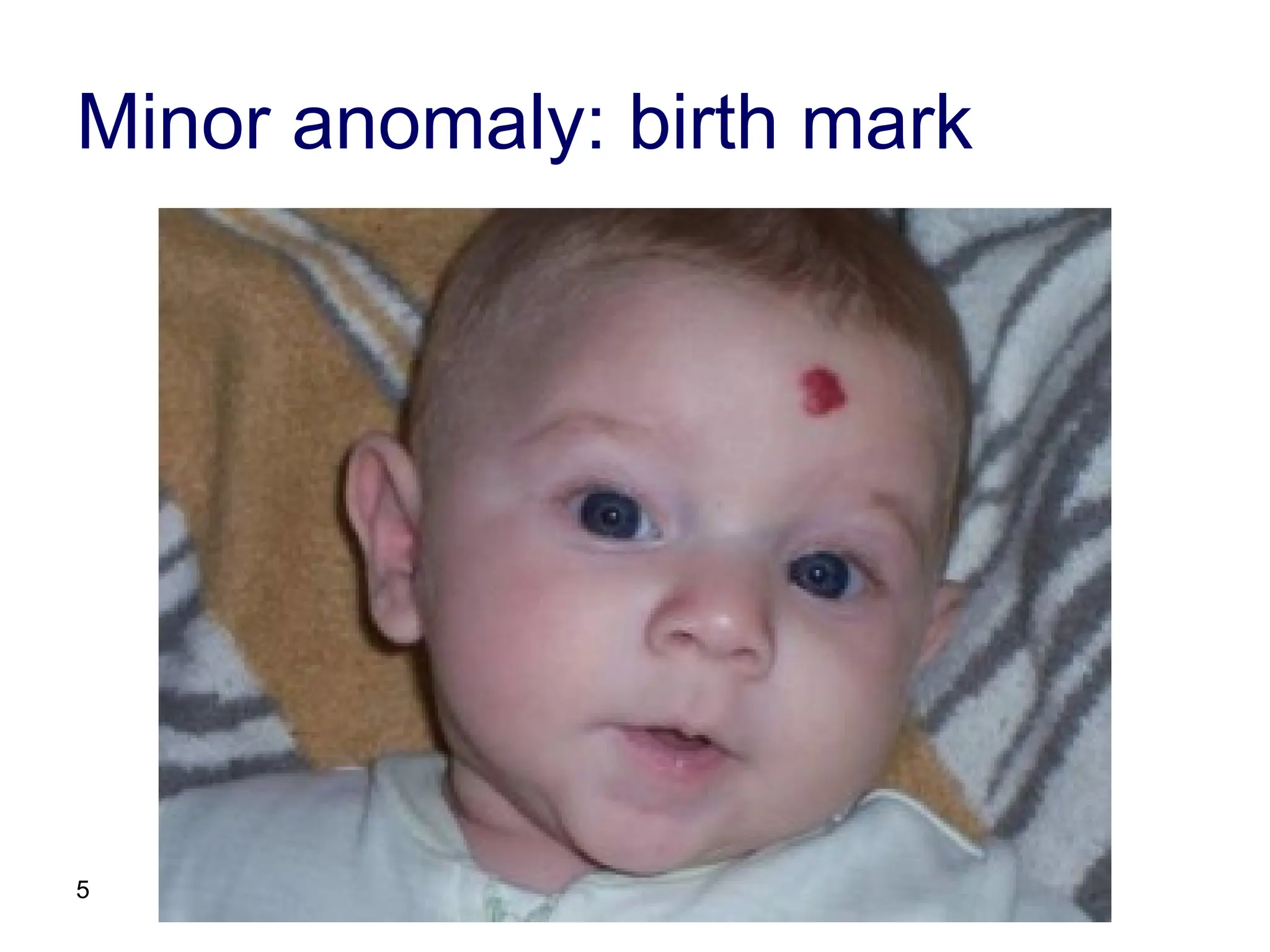 congenital anomalies.ppt FOR EASY READING | PPT