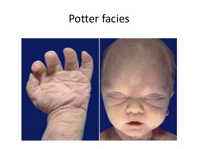 Congenital anomalies csbrp