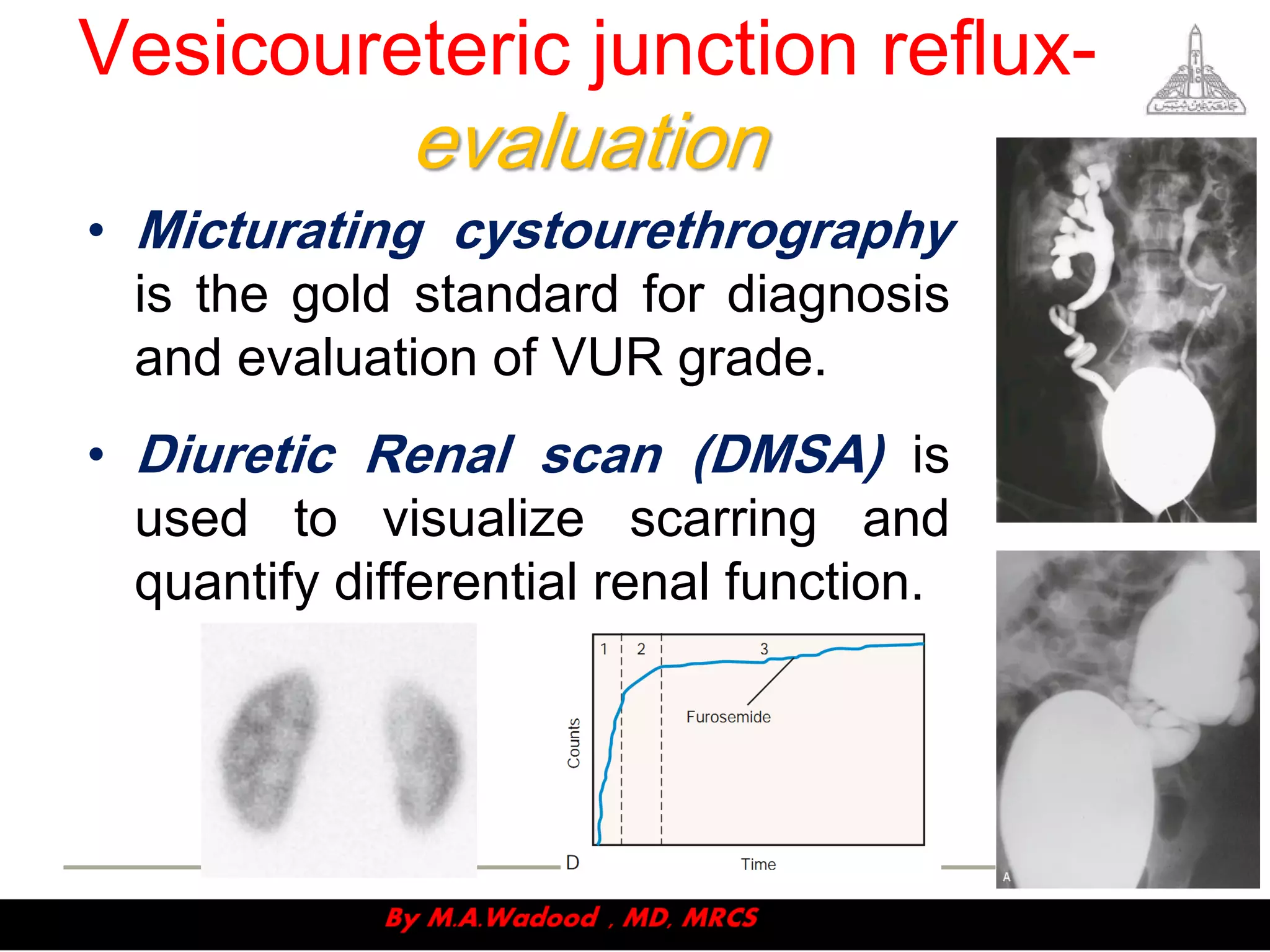 Congenital anomalies ppt | PDF