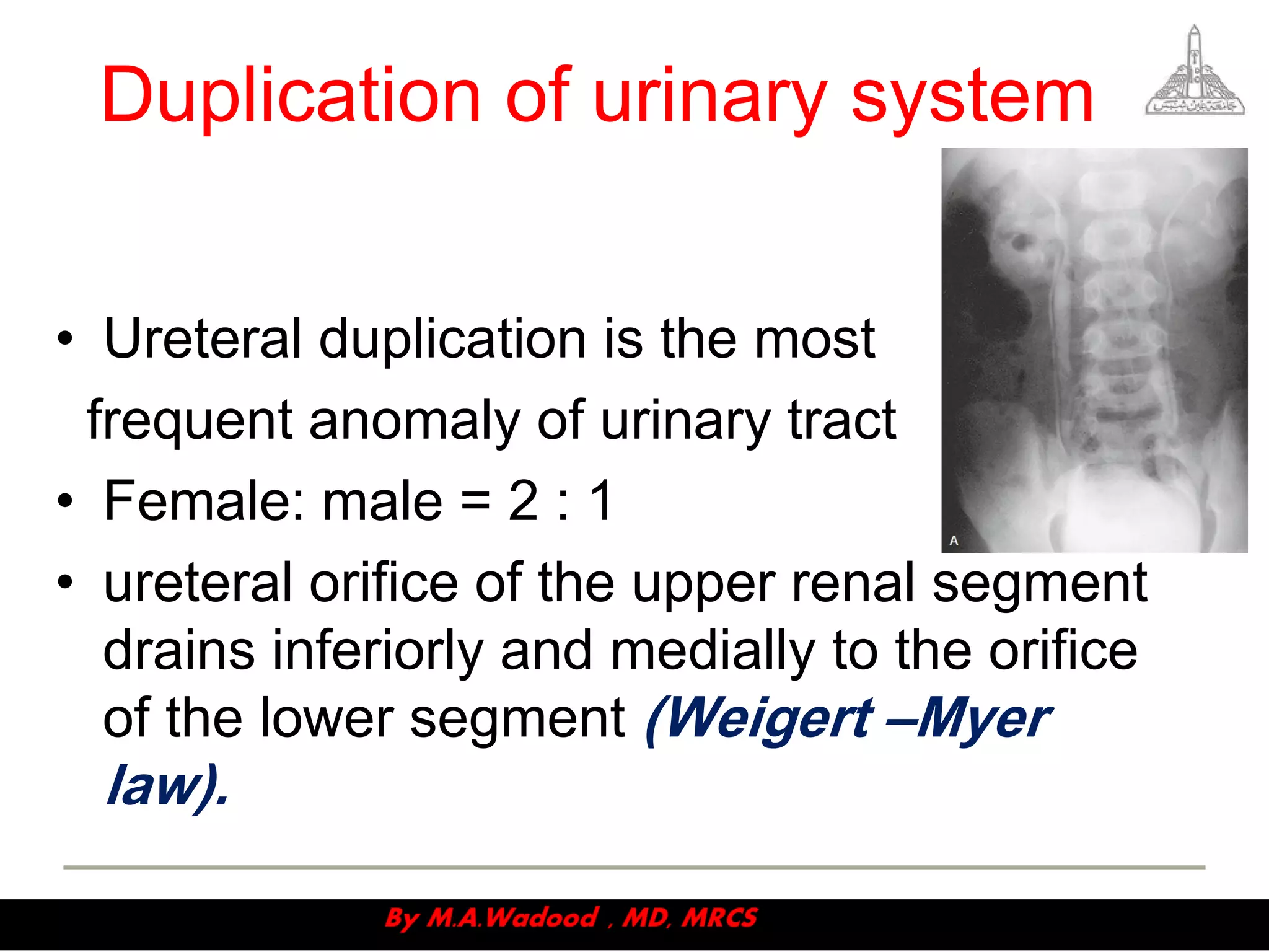 Congenital anomalies ppt | PDF