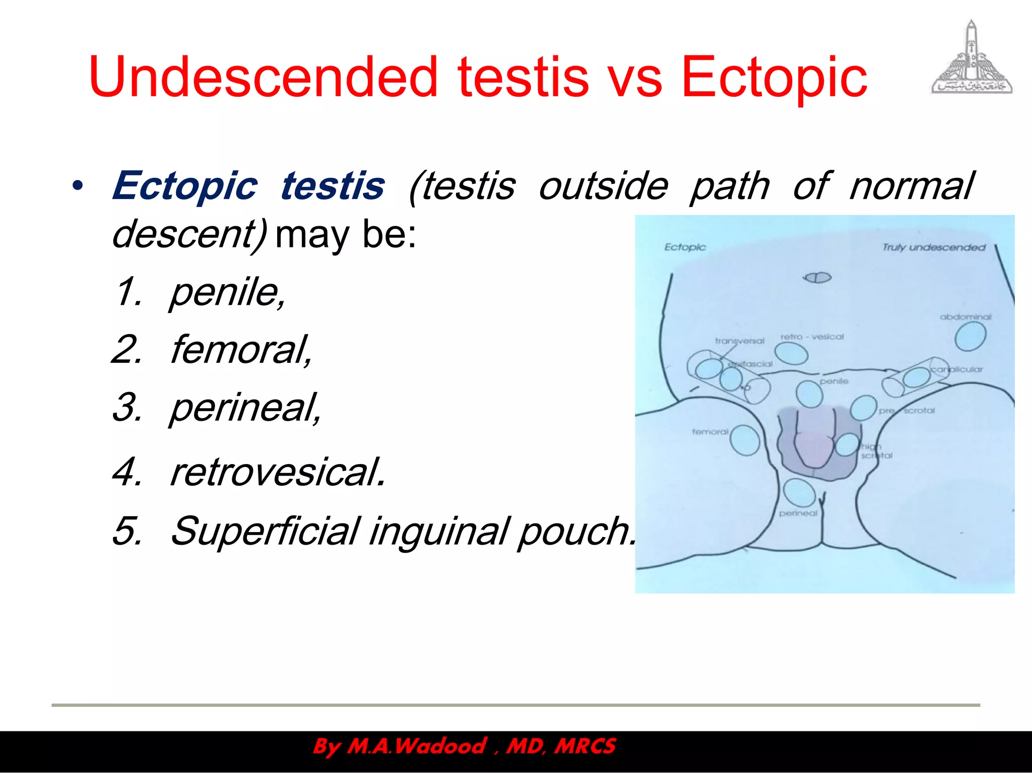 Congenital anomalies ppt | PDF