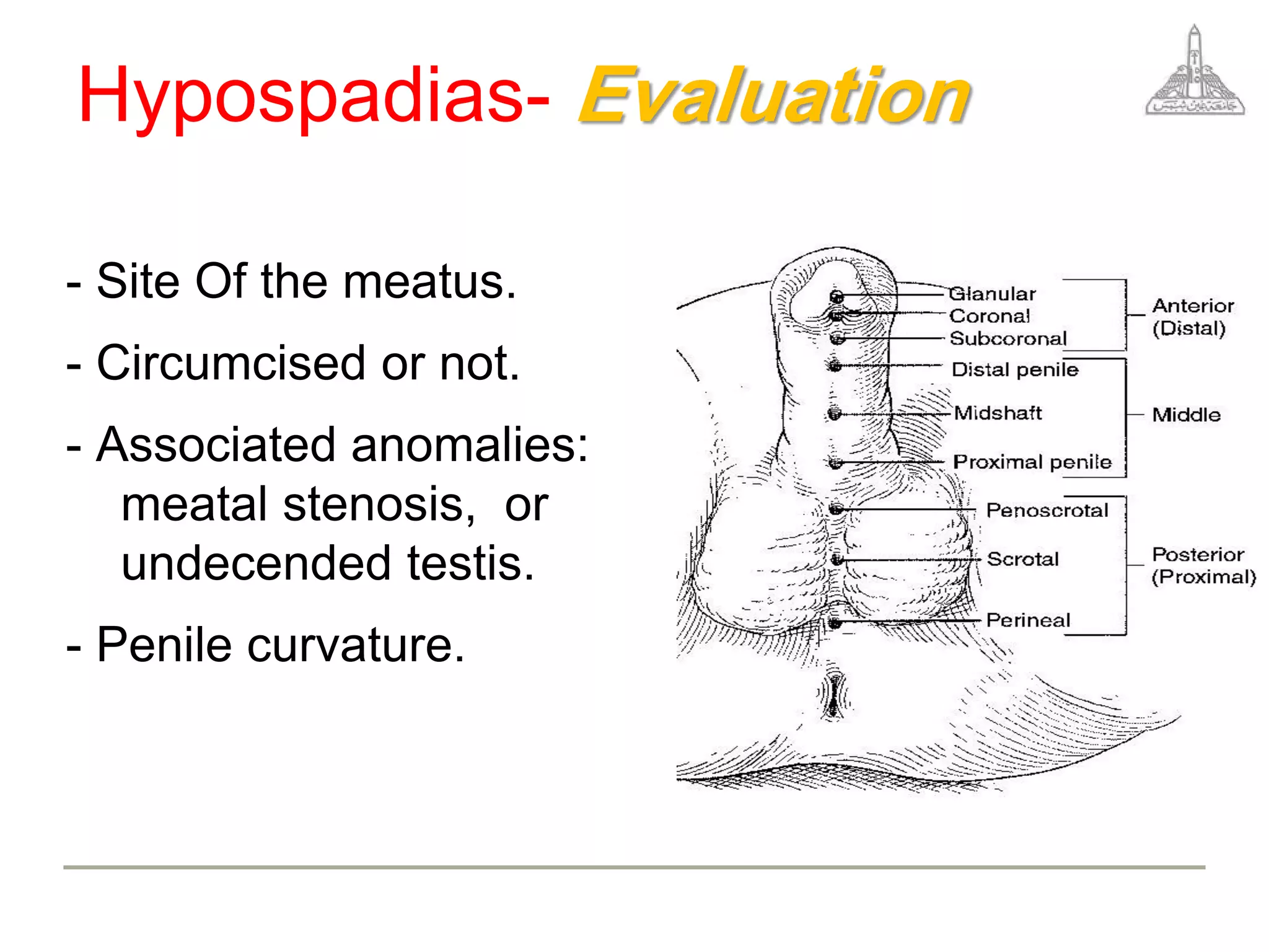 Congenital anomalies ppt | PDF