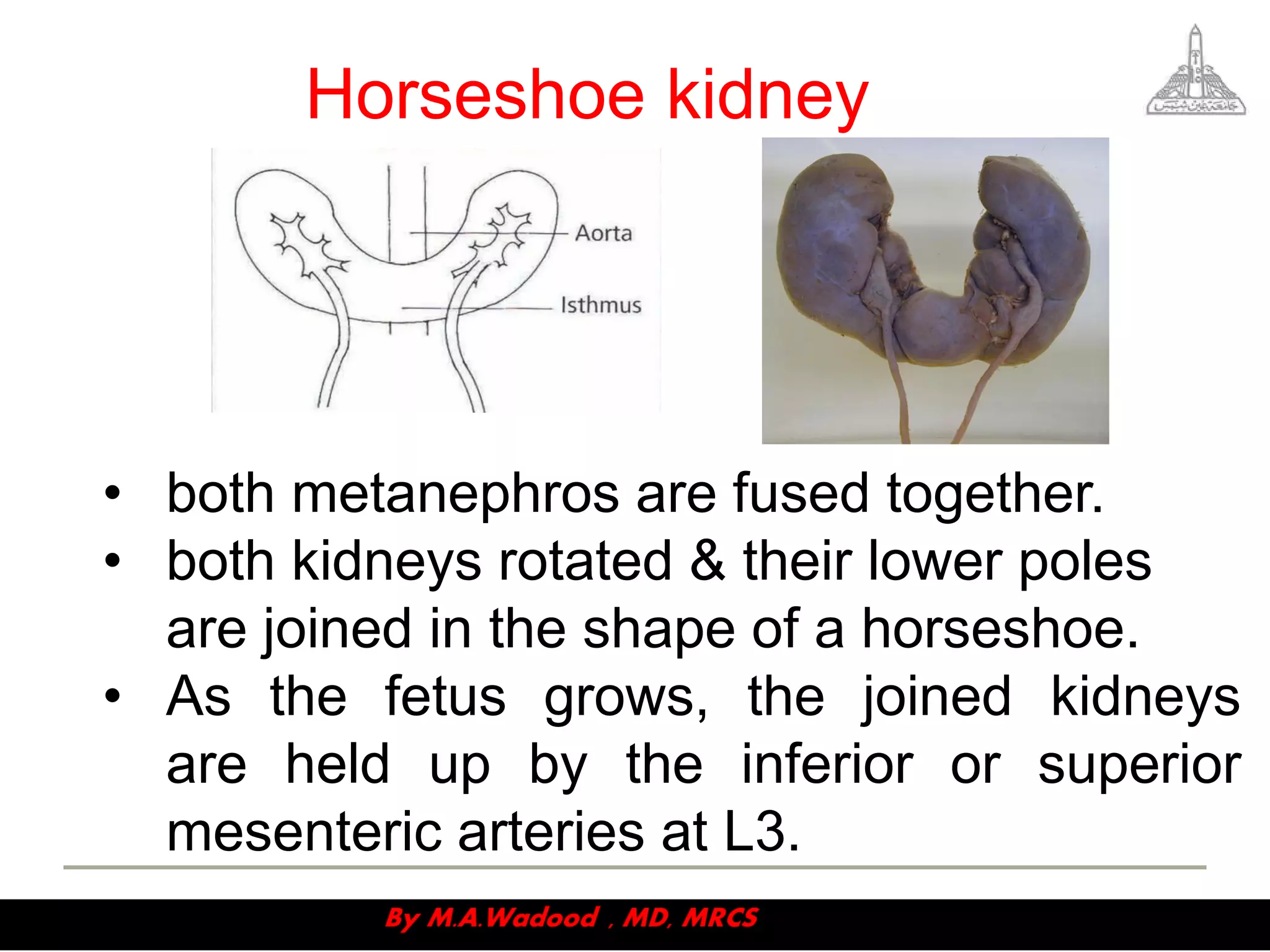 Congenital anomalies ppt | PDF