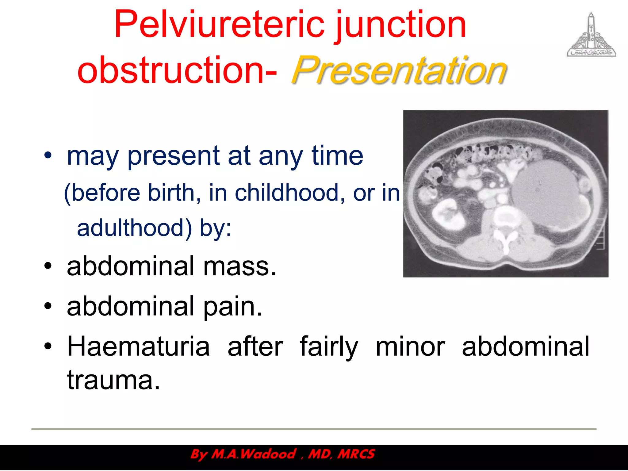 Congenital anomalies ppt | PDF