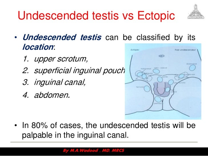 Congenital anomalies ppt