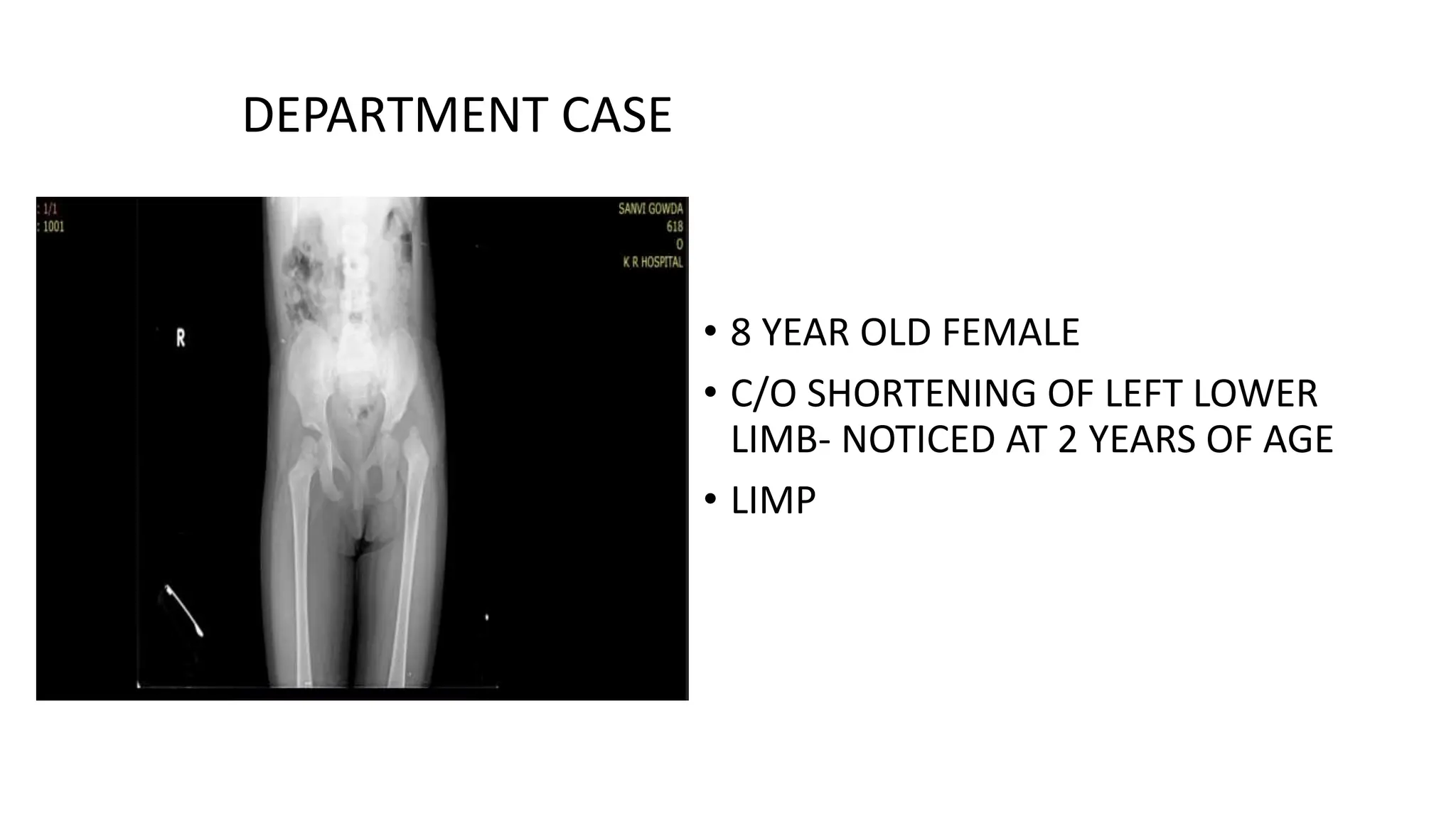 CONGENITAL ANOMALIES ANDNORMAL SKELETAL VARIENTS.pptx a.pptx final ppt.pptx