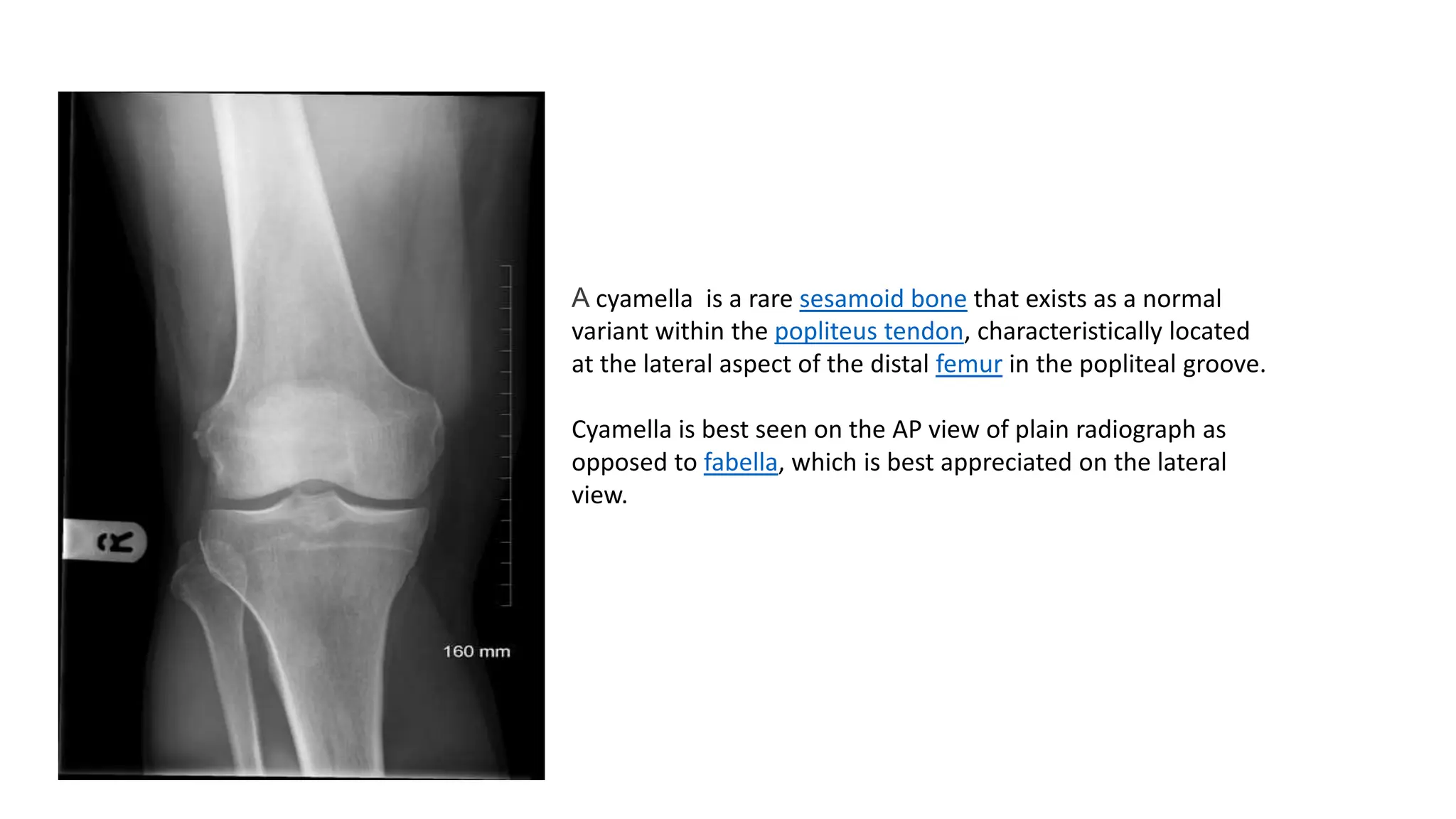 CONGENITAL ANOMALIES ANDNORMAL SKELETAL VARIENTS.pptx a.pptx final ppt.pptx
