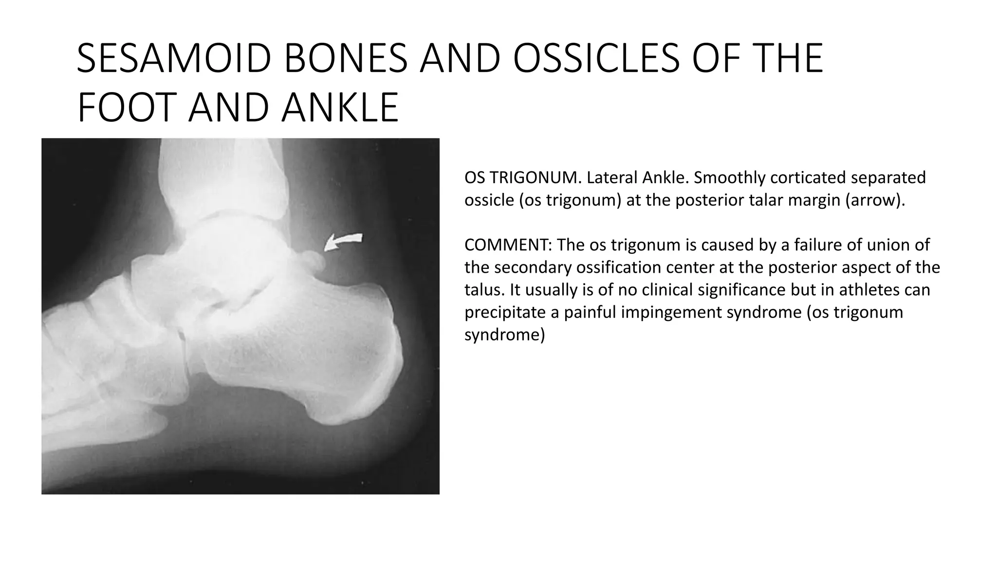 CONGENITAL ANOMALIES ANDNORMAL SKELETAL VARIENTS.pptx a.pptx final ppt.pptx