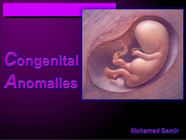 Congenital Anomalies