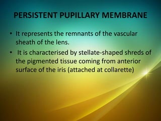 Congenital anomalies in the eye | PPTX