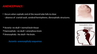 Congenital anomalies of brain radiology 2.pptx