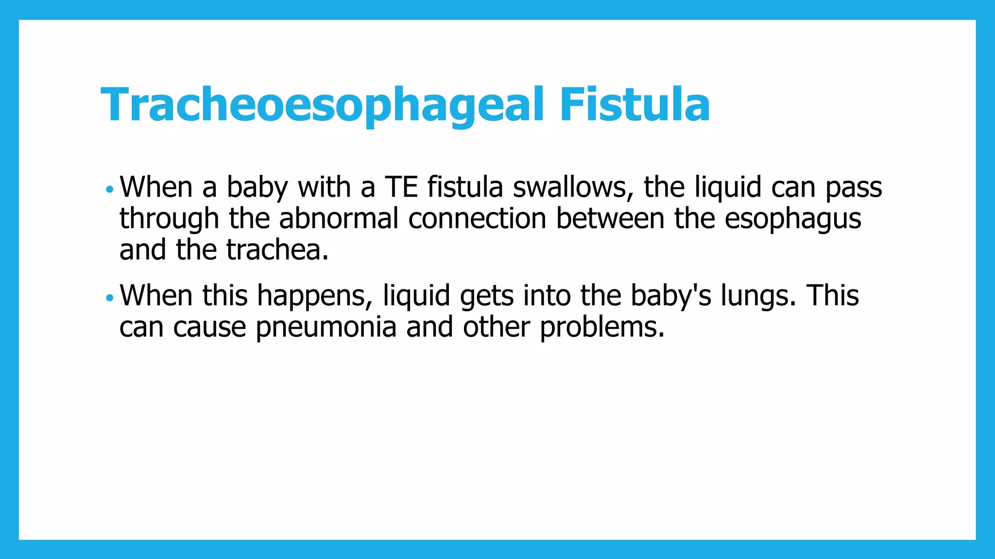 Congenital anomalies of esophagus | PDF