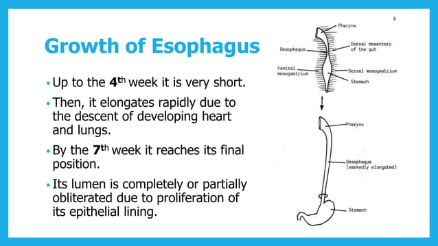 Congenital anomalies of esophagus | PDF