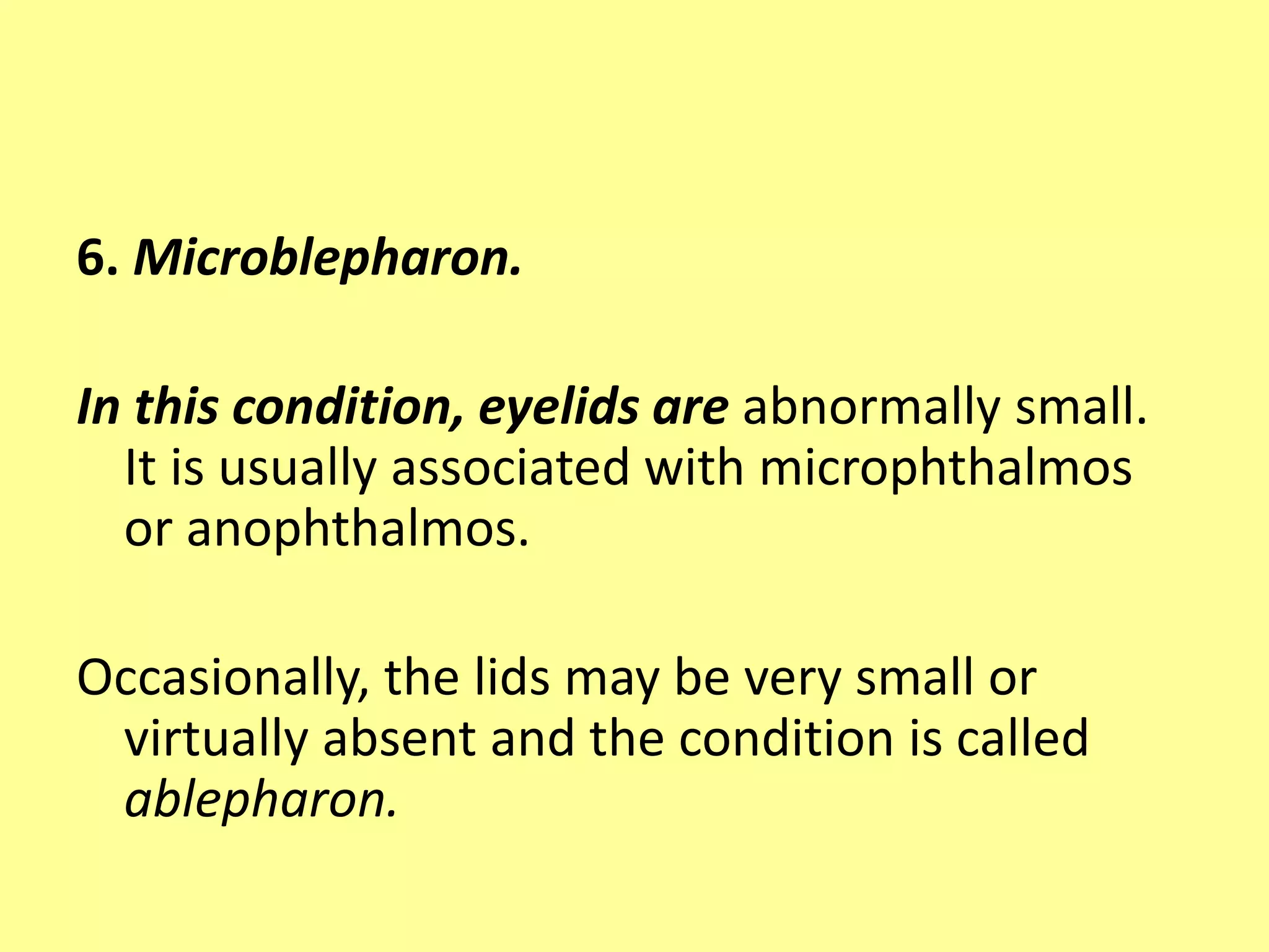 Congenital anomalies of eyelid Quick Review | PPTX