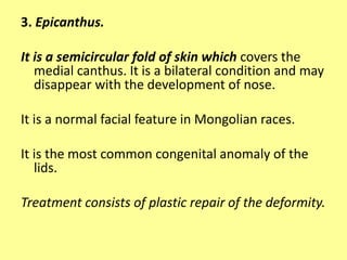 Congenital anomalies of eyelid Quick Review | PPTX