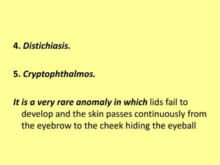 Congenital anomalies of eyelid Quick Review | PPTX