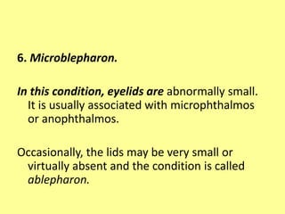 Congenital anomalies of eyelid Quick Review | PPTX