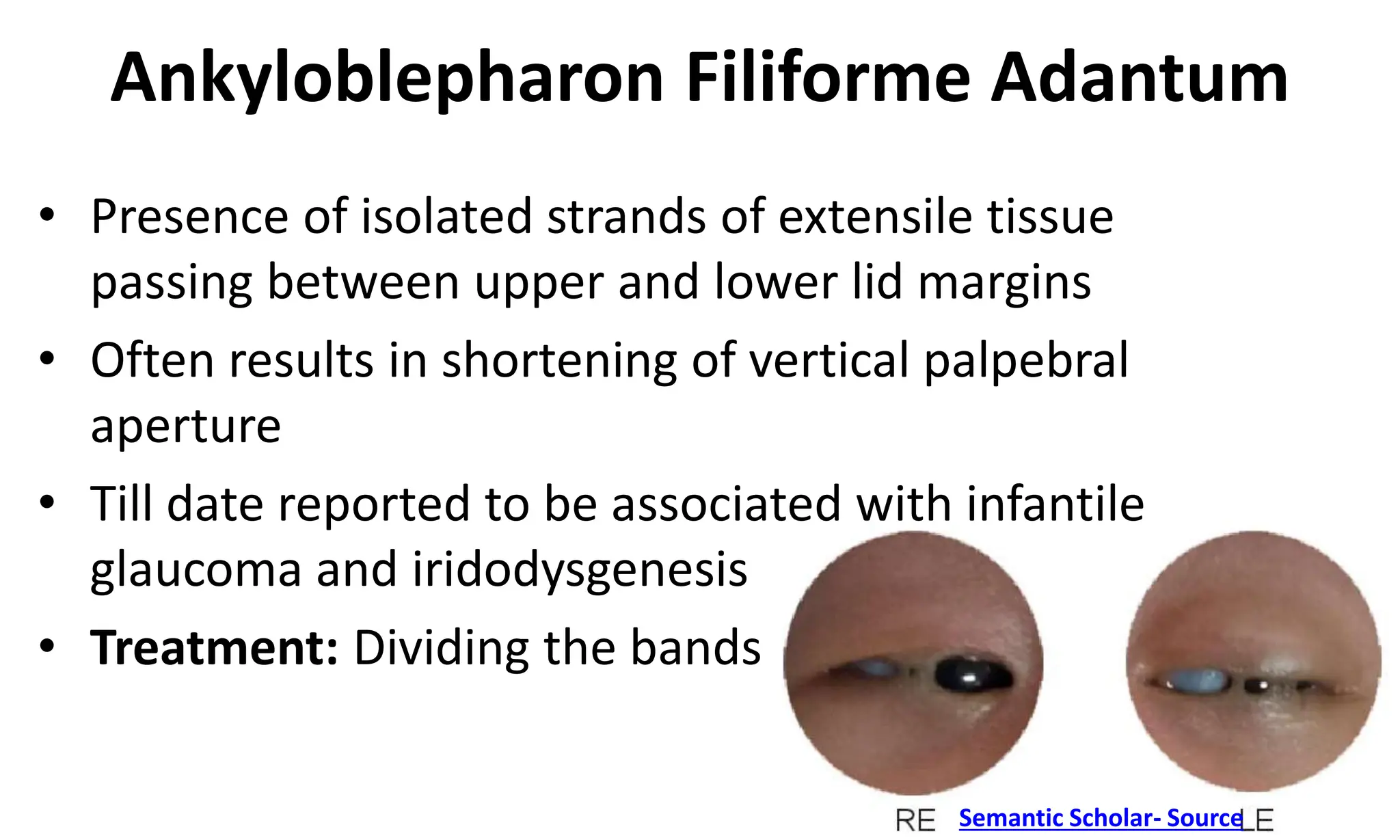 Congenital Anomalies of Eyelids and Orbit Dr. Prabhat Devkota.pptx