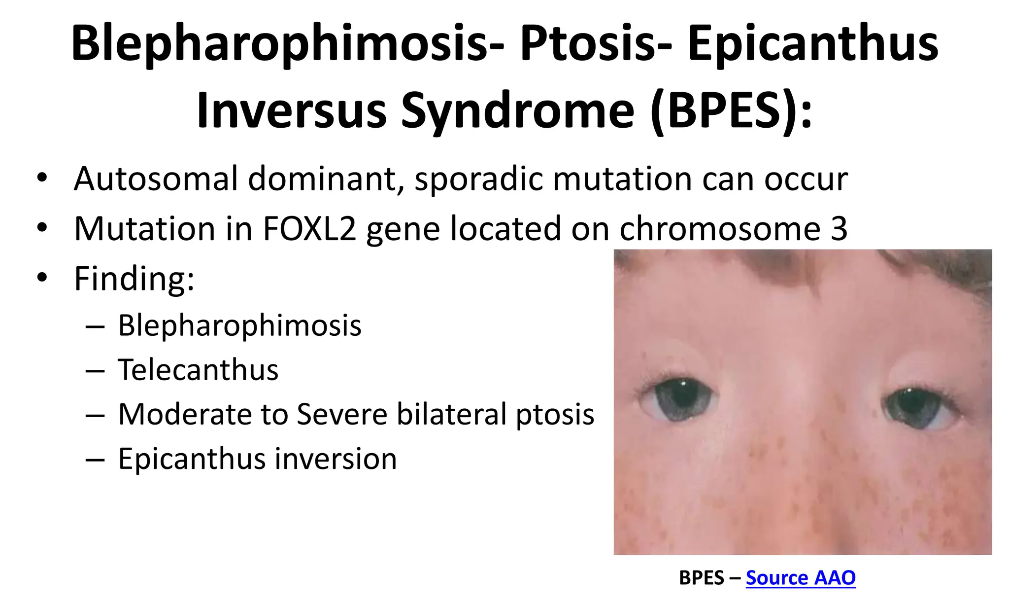 Congenital Anomalies of Eyelids and Orbit Dr. Prabhat Devkota.pptx