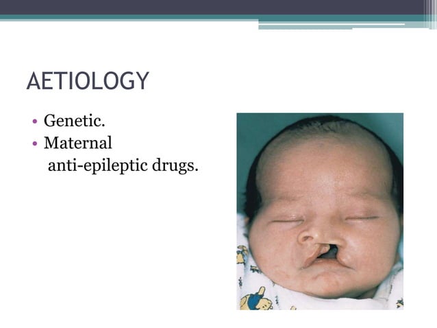 Congenital anomalies of face & urinary system Dr Hatem El Gohary | PPT