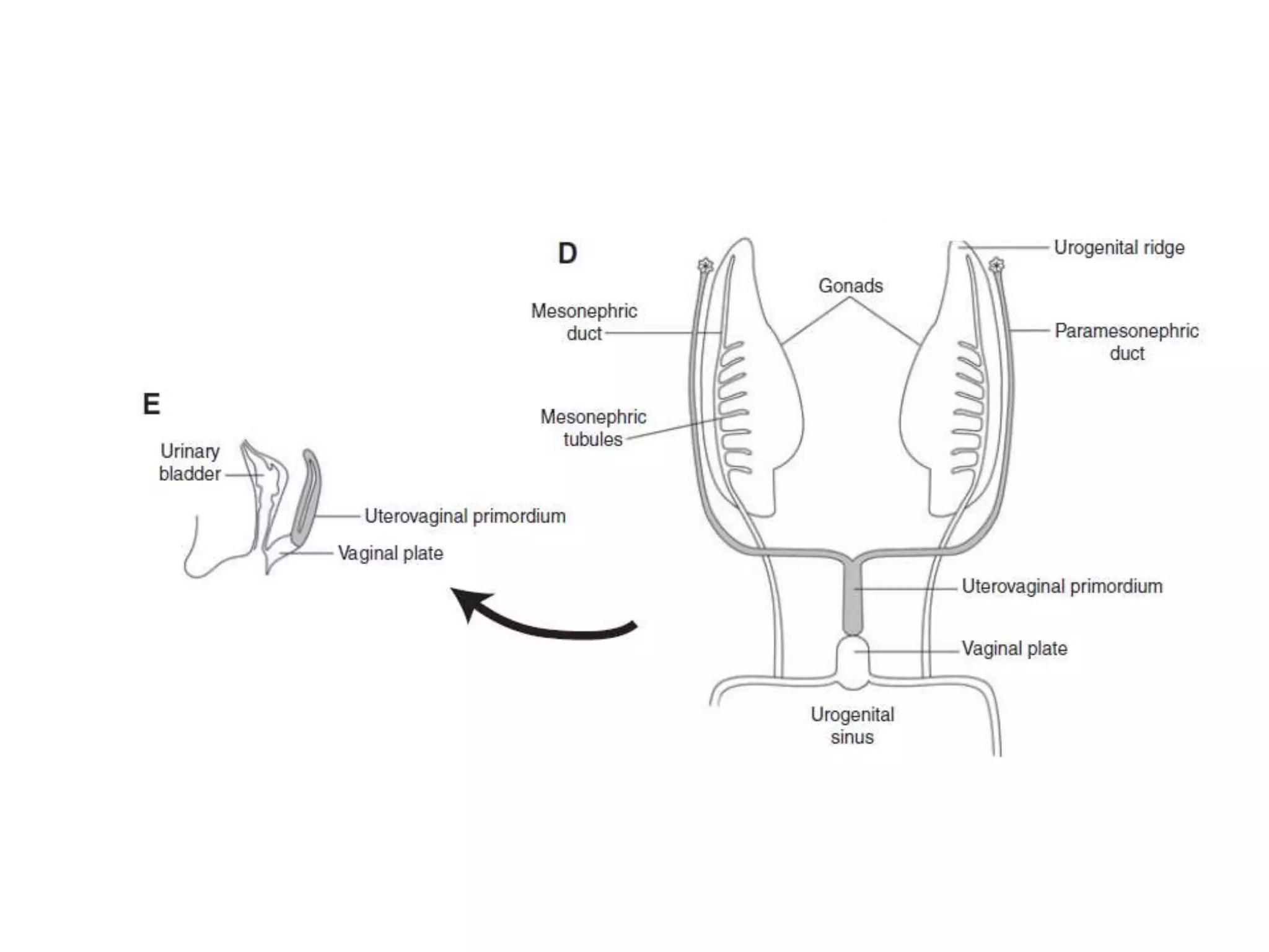 Congenital Anomalies Of Female Reproductive System Ppt
