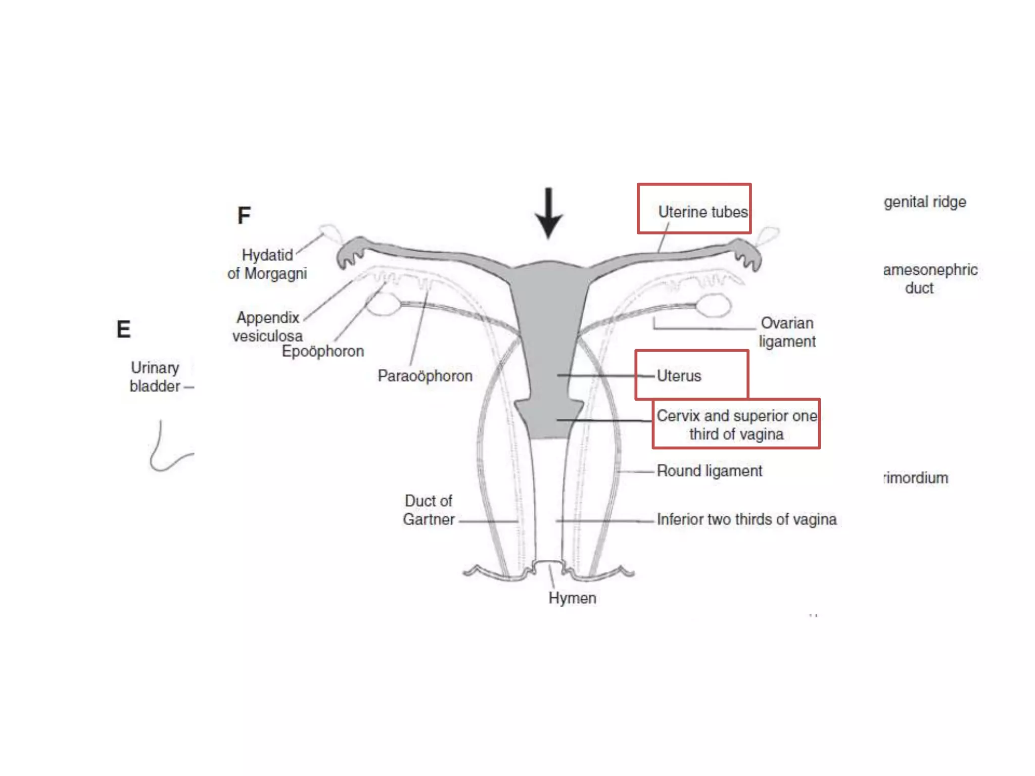 Congenital anomalies of female reproductive system | PPTX