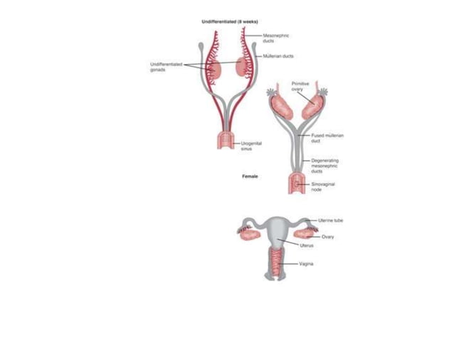 Congenital anomalies of female reproductive system | PPTX | Pregnancy ...
